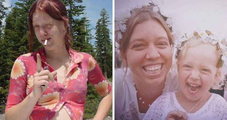 How Drug Addiction Looks Before And After (40 pics) - Izismile.com