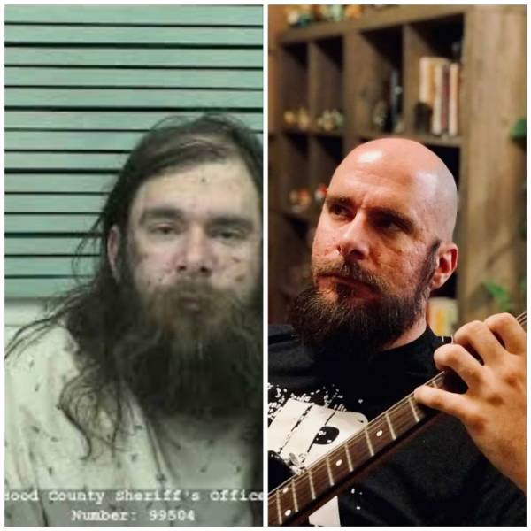 How Drug Addiction Looks Before And After (40 pics) - Izismile.com