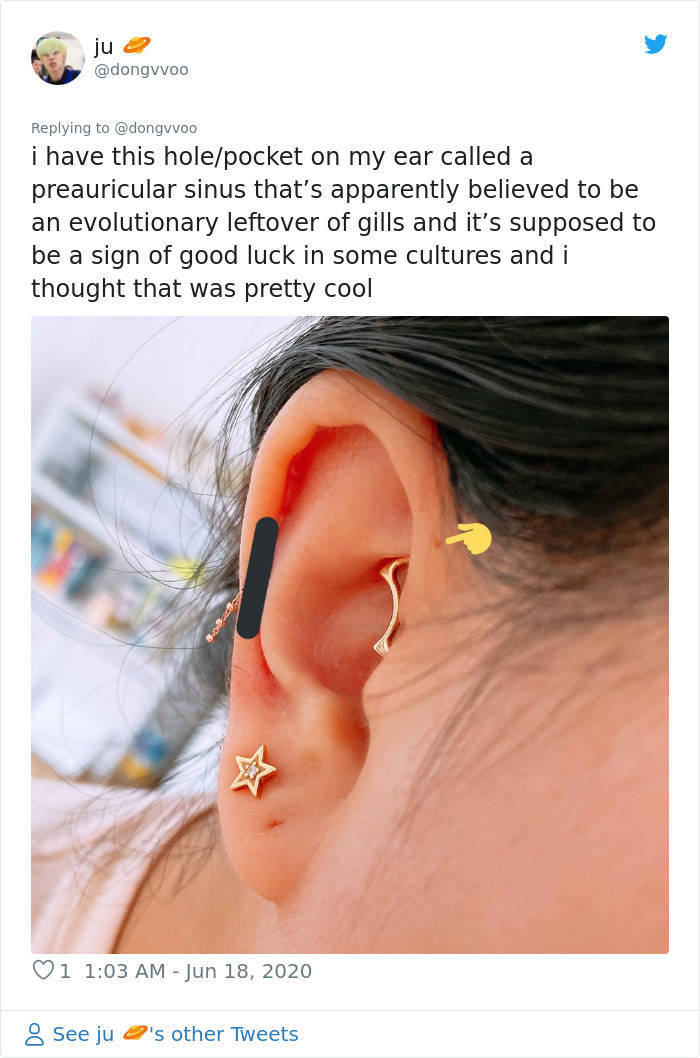 But What If That Tiny Hole Above Your Ear Serves A Purpose? (8 pics + 1 ...