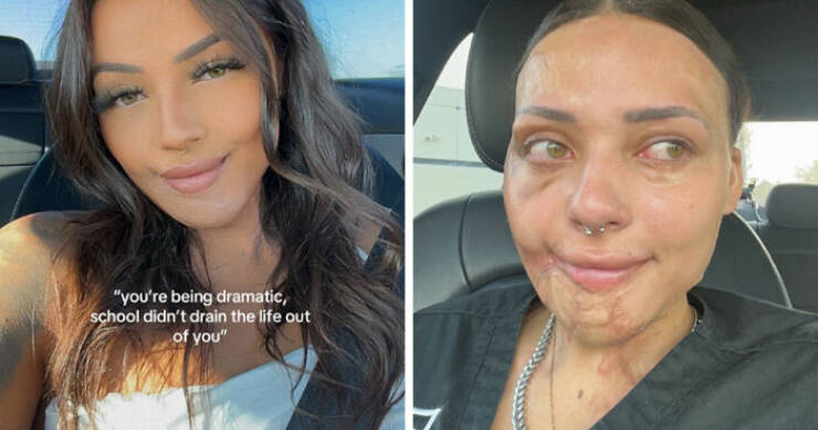 People Share Pics Of Before And After “Life Happened” To Them (25 PICS ...