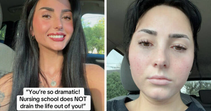 People Share Pics Of Before And After “Life Happened” To Them (25 PICS ...