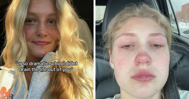 People Share Pics Of Before And After “Life Happened” To Them (25 PICS ...