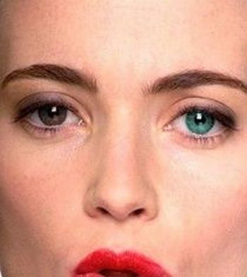 Why having one eye color when you can have two? (15 pics) - Izismile.com