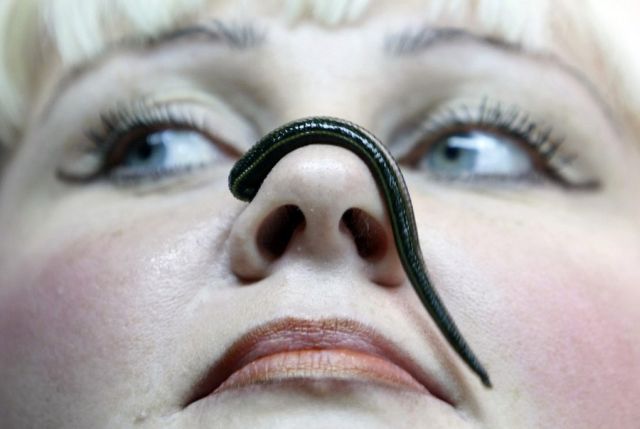 Leech Farm (10 pics) - Izismile.com