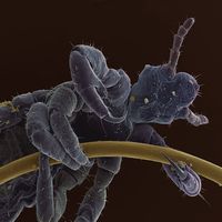 Amazing Scanning Electron Microscope Pictures (24 pics) - Picture #19 ...