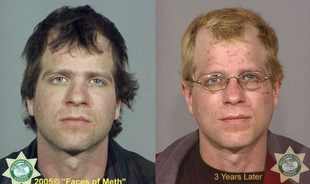 Faces Of Crack Before And After Pictures - programsolar