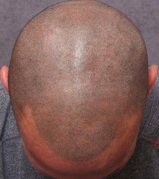The ‘No Hair’ Solution! (9 pics) - Izismile.com