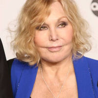 Kim Novak Before and After Plastic Surgery (16 pics) - Picture #5 ...